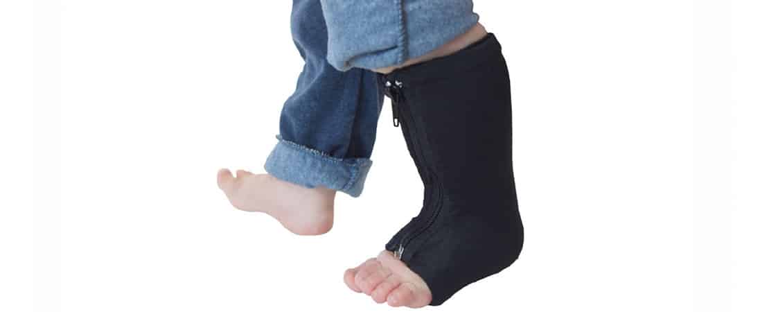 Serial Casting and Turtle Brace - Services | Let's Go Physio